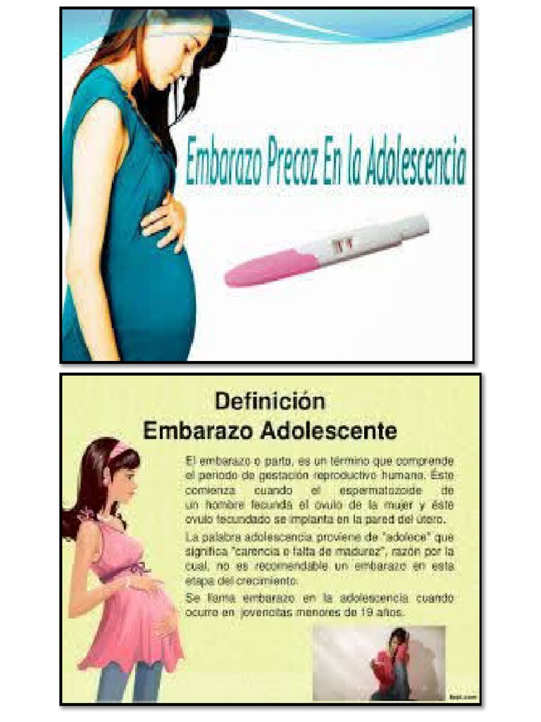 El Embarazo Precoz | PDF