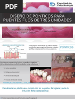 TiPos D Ponticos | PDF | Diente