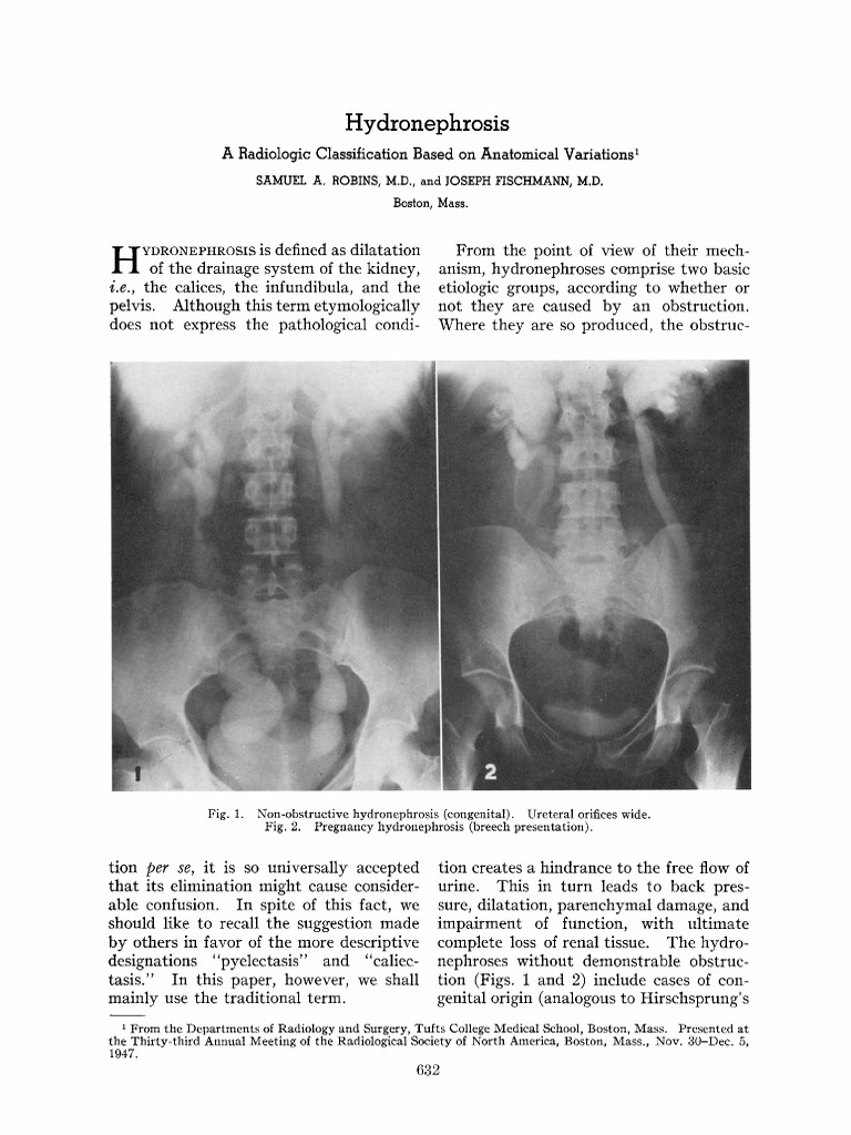 Hydronephrosis: A Radiologic Classification Based On Anatomical ...