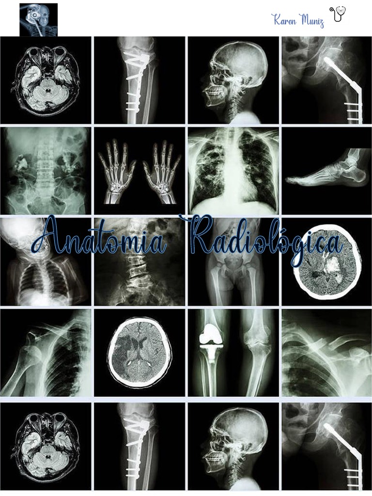 Anatomia Radiológica- Resumo OK | PDF | Coração | AVC