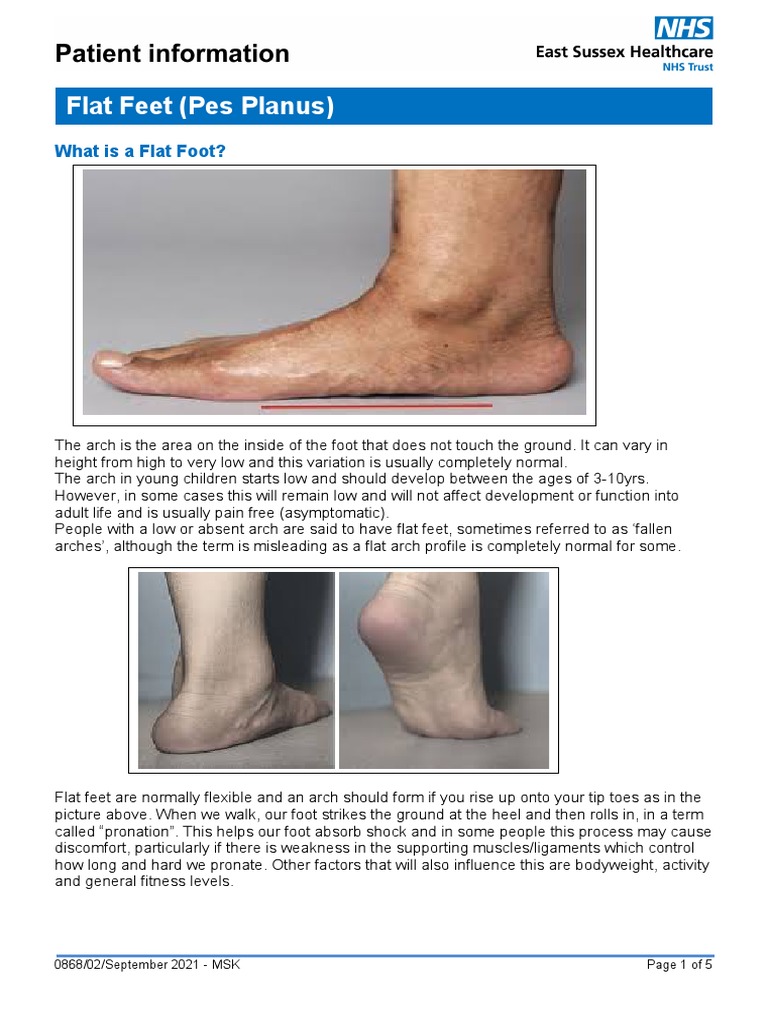 Flat Feet (Pes Planus) : What Is A Flat Foot? | PDF | Foot | Causes Of ...