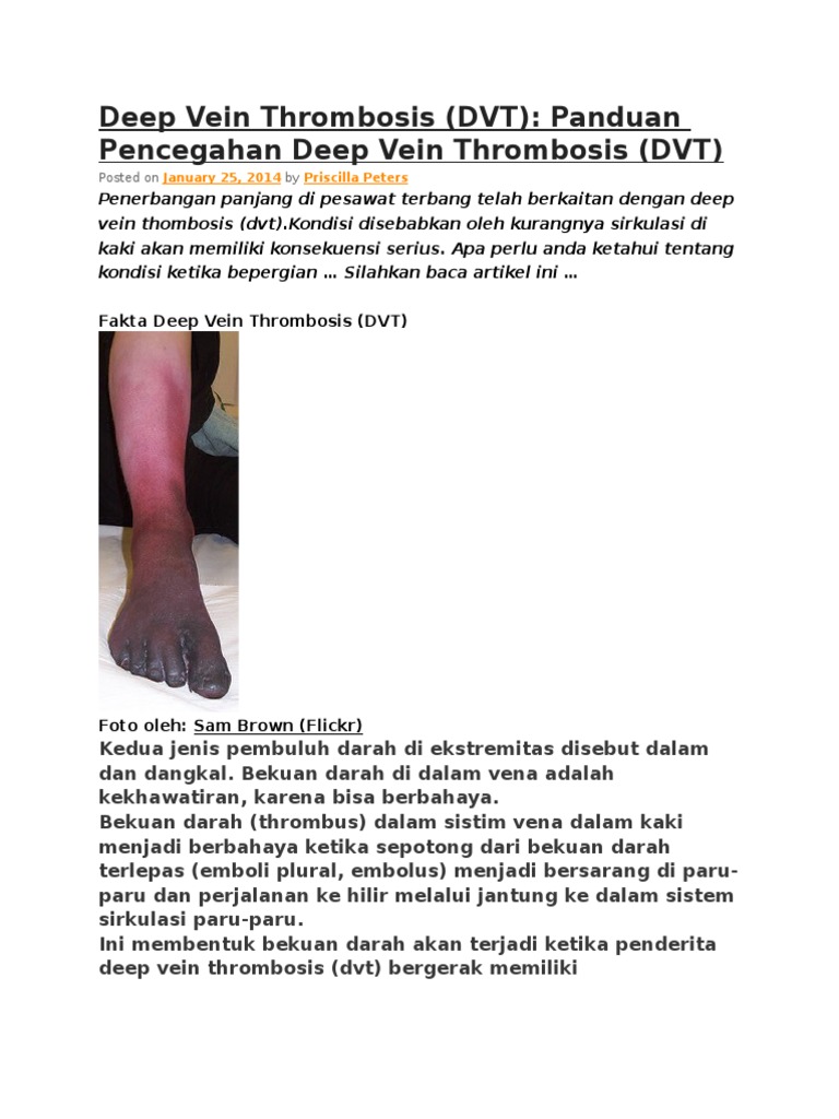 Deep Vein Thrombosis | PDF