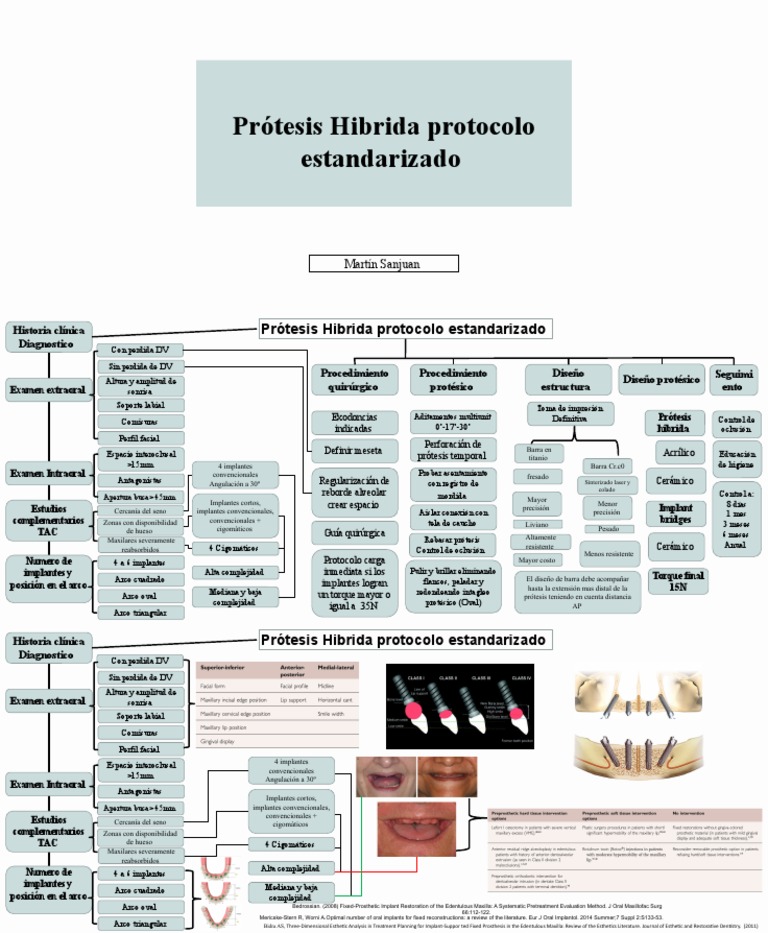 Prótesis Hibrida Protocolo Estandarizado | PDF | Dentadura postiza ...