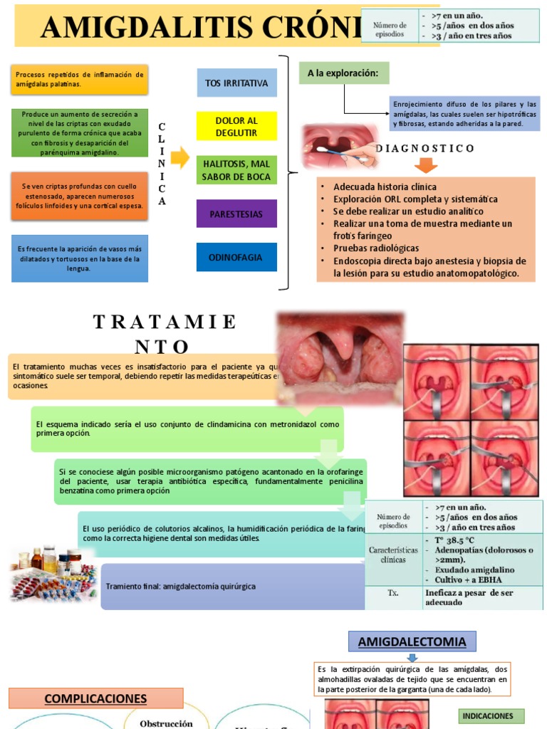 Amigdalitis Cronica | PDF | Inmunología | Epidemiología