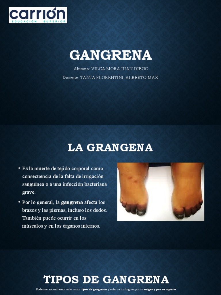 Tipos y Tratamiento de Gangrena | PDF | Sangre | Ciencias de la Salud