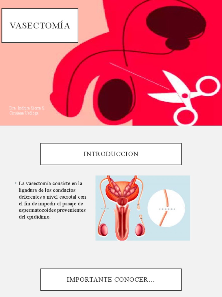 Vasectomia | PDF | Especialidades Medicas | Medicina CLINICA