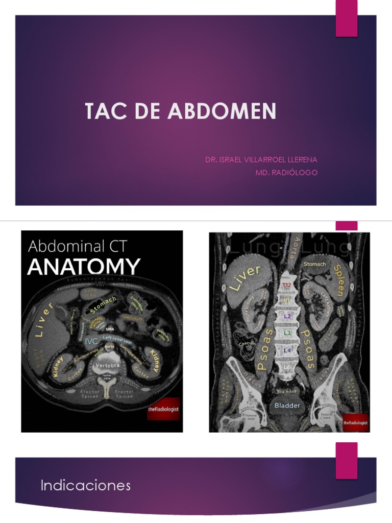 Tac de Abdomen PDF | PDF