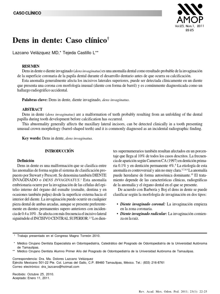 Dens in Dente: Análisis de un Caso Clínico | PDF | Esmalte de dientes ...