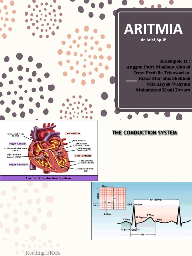 Panduan Lengkap Aritmia Jantung | PDF