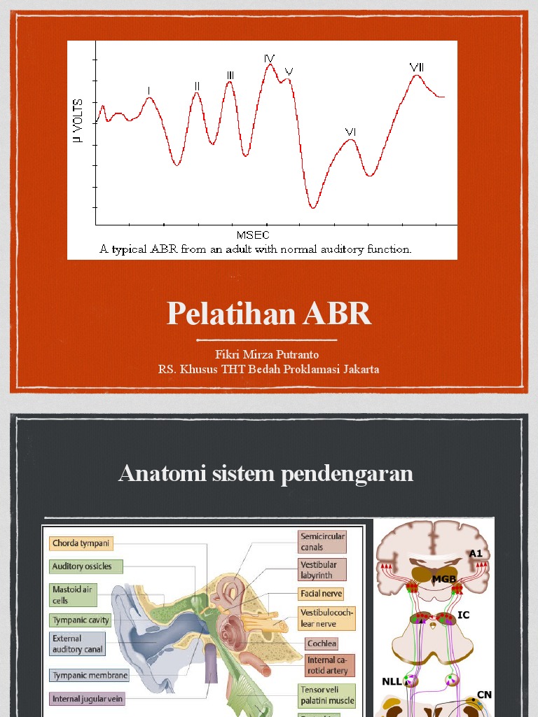 Prosedur dan Hasil Tes ABR pada Anak | PDF