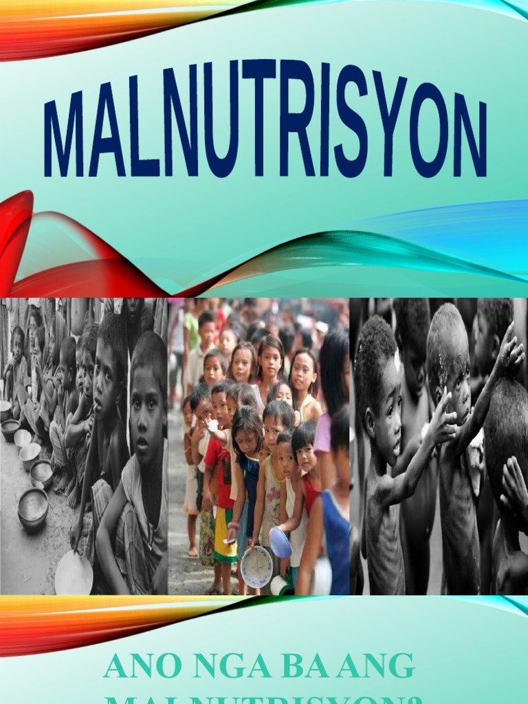 MALNUTRISYON | PDF
