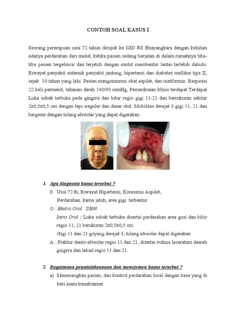 Contoh Soal Kasus Al | PDF