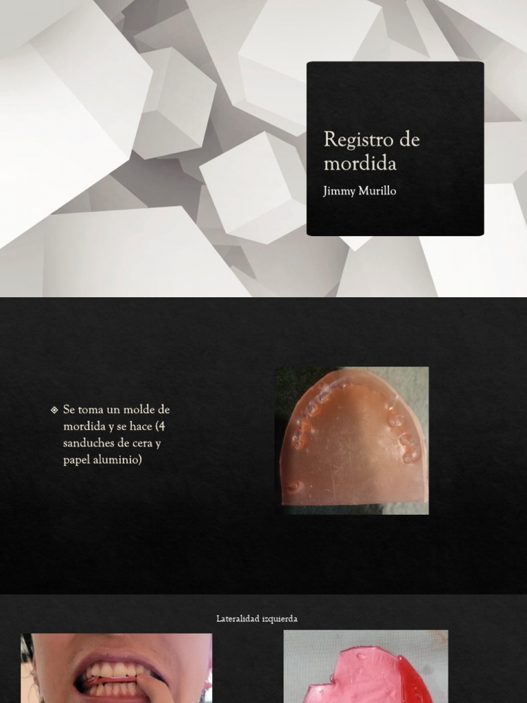 Registro de Mordida | PDF | Hogar, jardinería y bricolaje