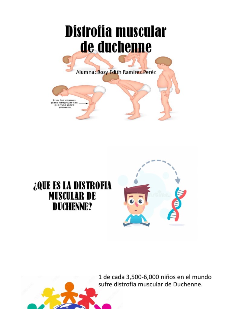 Distrofia Muscular | PDF