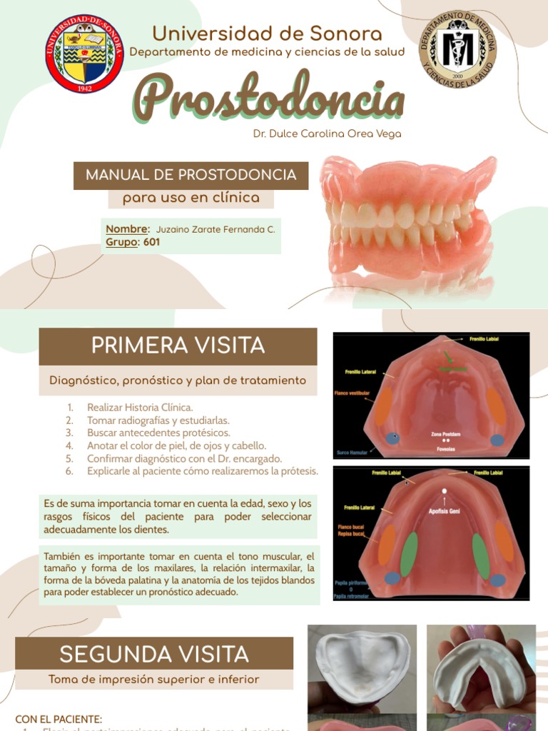 Prostodoncia - Fernanda Juzaino | Descargar gratis PDF | Diente ...