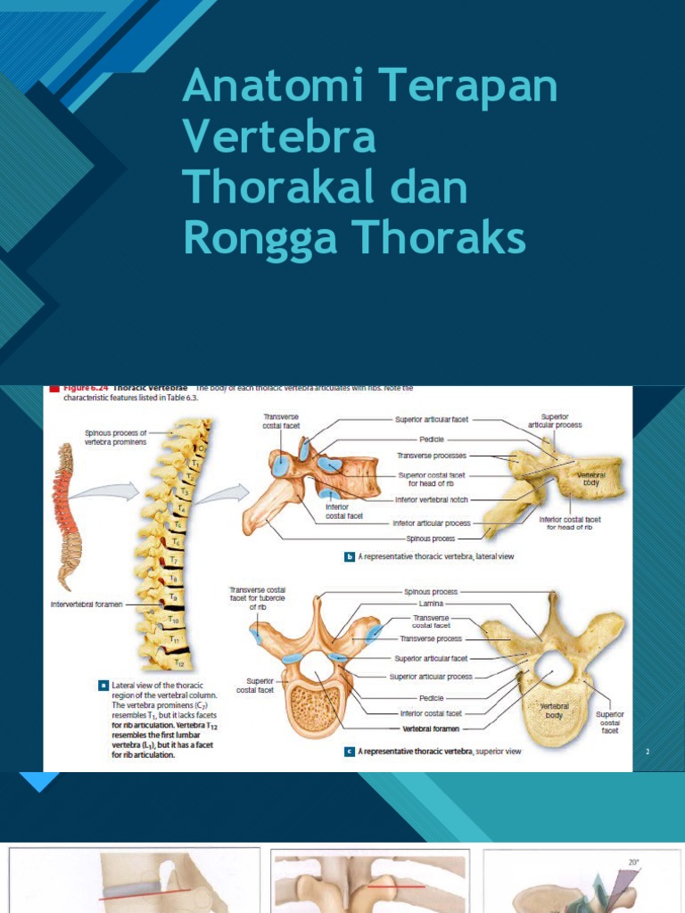 Anatomi Terapan Vertebra Thorakal Dan Rongga Thoraks | PDF | Skeletal ...