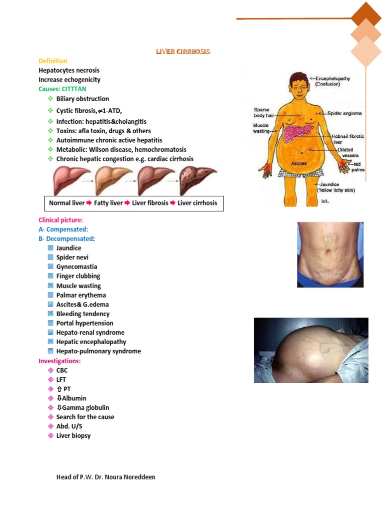 Causes: CITTTAN: Liver Cirrhosis | PDF