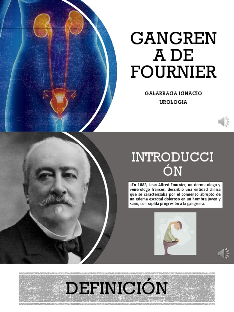 Gangrena de Fournier CEREIJO | PDF | Especialidades Medicas | Medicina ...