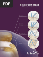 AC Joint Repair Arthrex | PDF | Surgical Suture | Joints