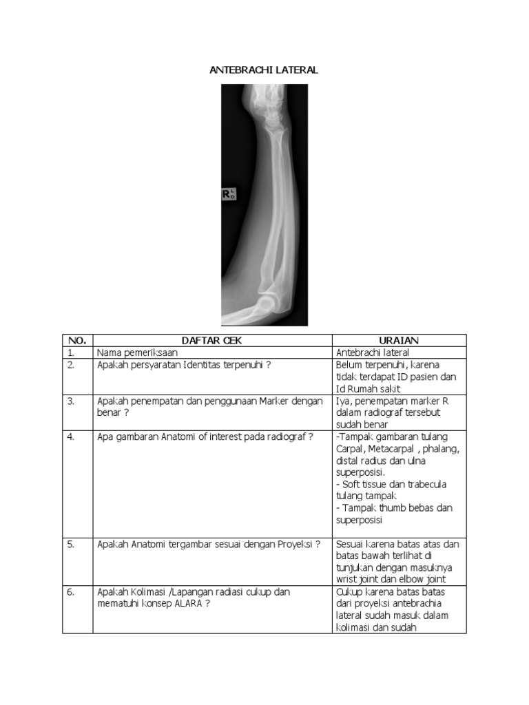 Antebrachi Lateral | PDF