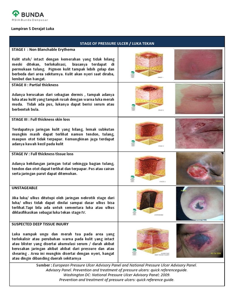 04a. Derajat Luka Tekan | PDF