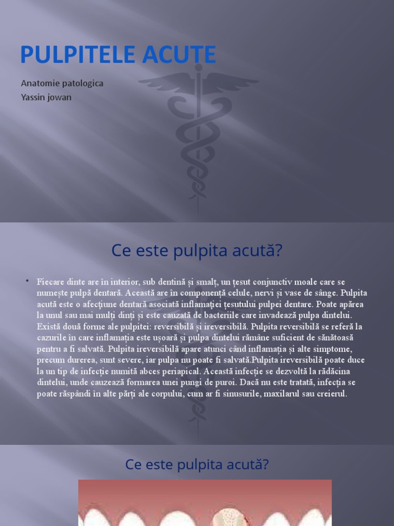 Pulpitele Acute | PDF