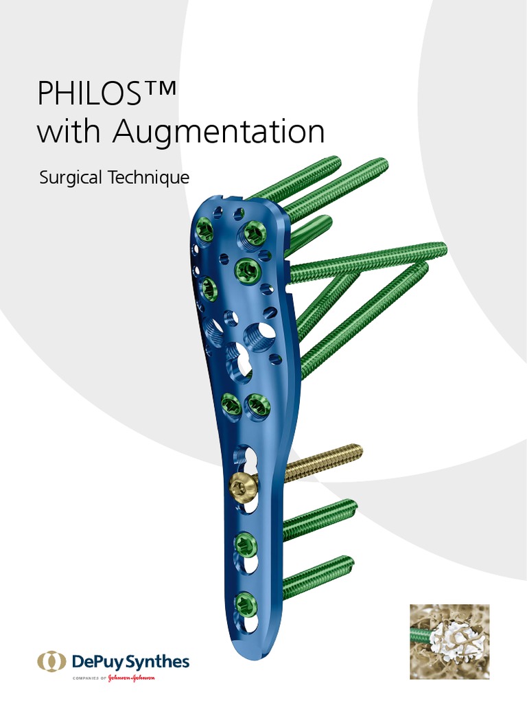 PHILOS - With Augmentation. Surgical Technique - DSEMTRM061400876 | PDF ...