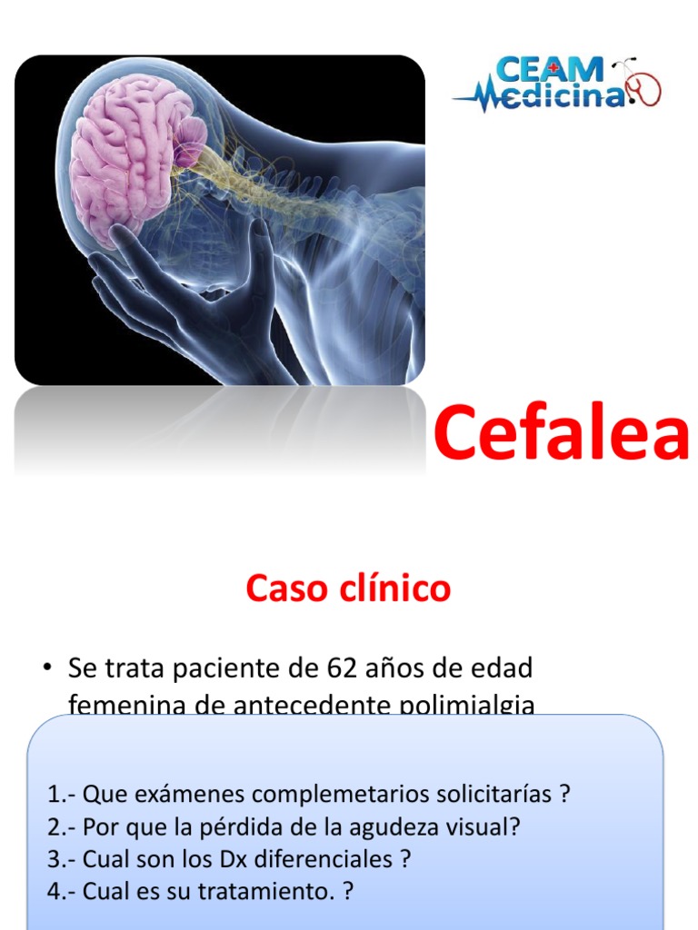 Cefalea | PDF | Dolor de cabeza | Migraña
