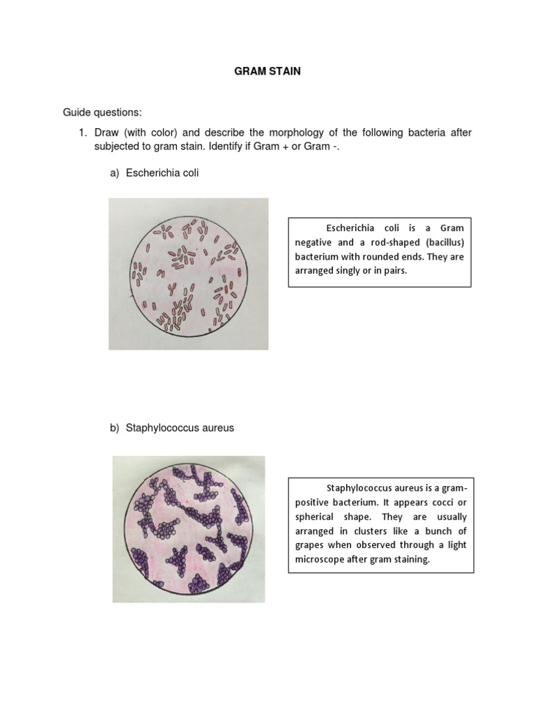 Gram Stain Final | Download Free PDF | Gram Positive Bacteria | Staining