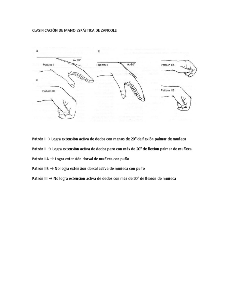 Clasificación de Mano Espástica de Zancolli | PDF