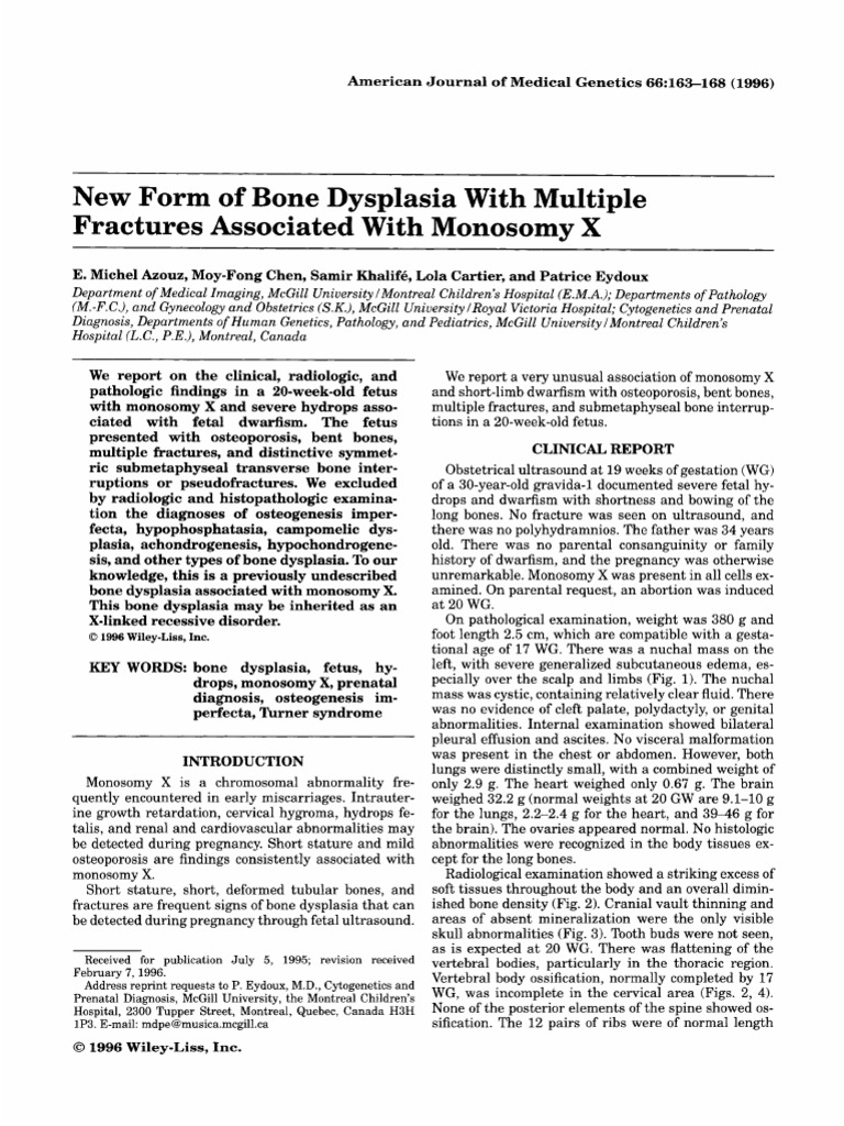 New Form of Bone Dysplasia With Multiple Fractures Associated With ...