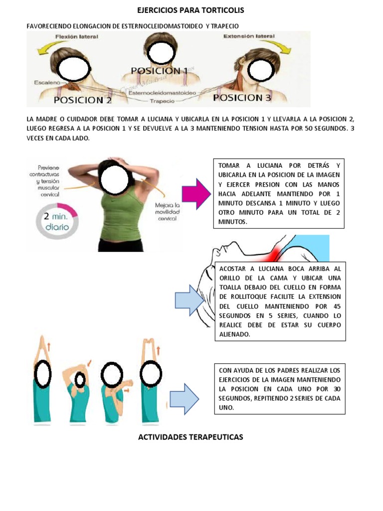 Ejercicios para Torticolis | PDF