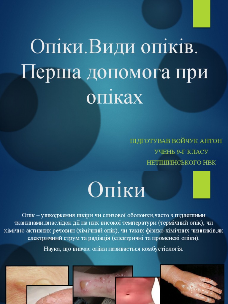 Prezentaciya Na Temu Opiky Vydy Opikiv Persha Dopomoga Pry Opikah | PDF