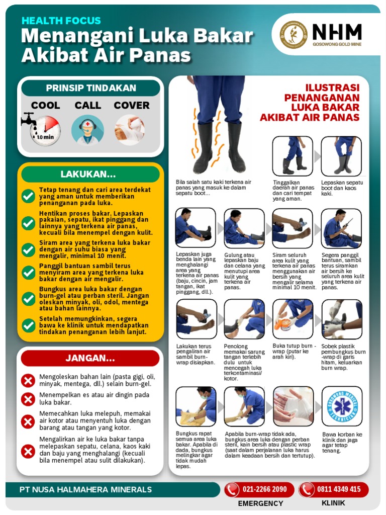 Penanganan Luka Bakar Air Panas | PDF