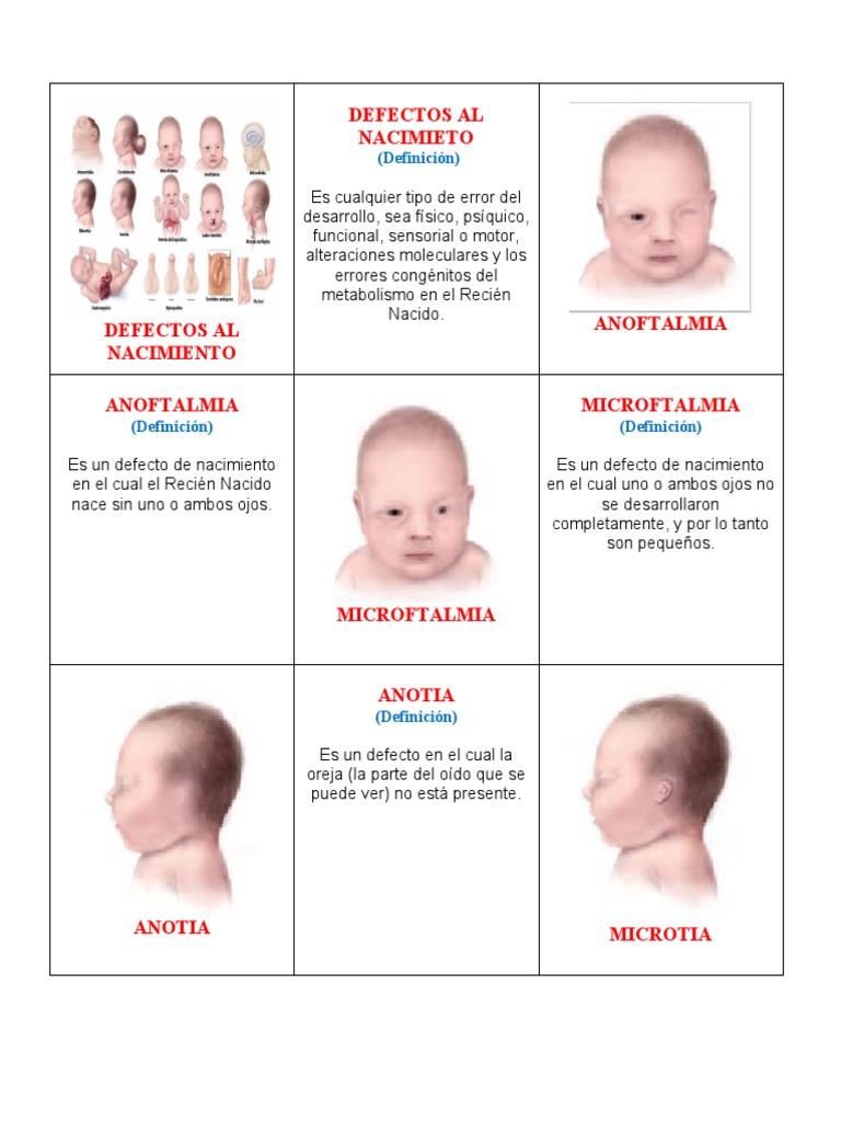 MEMORAMA (defectos congenitos) | PDF | Abdomen | Síndrome de Down
