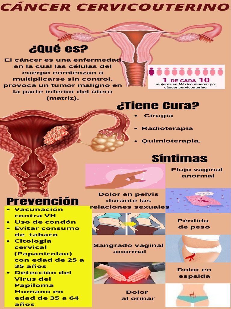 cancer cervicouterino | PDF