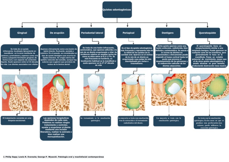 Quistes Odontogénicos Descargar Gratis Pdf Diente Hueso