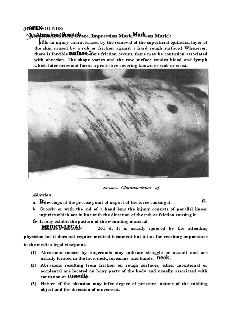 OPEN WOUNDS Abrasion Deep and Superficial | PDF | Injury | Wear