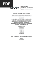 Infradesnivel y Supra del ST en ECG | PDF