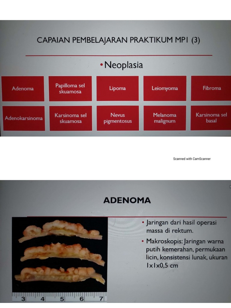 Praktikum Patologi Anatomi 3 | PDF