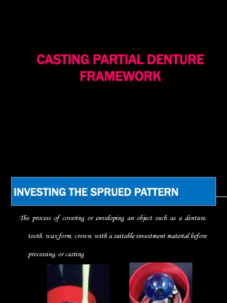 RPD Casting | PDF | Casting (Metalworking) | Casting