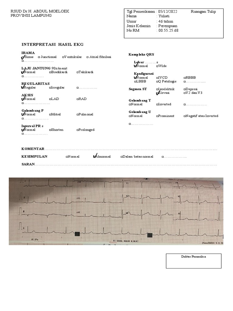 Interpretasi EKG Pasien Yuliati 46 Tahun | PDF