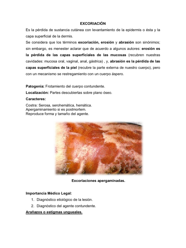 EXCORIACIÓN | PDF | Clavo (anatomía) | Sangre