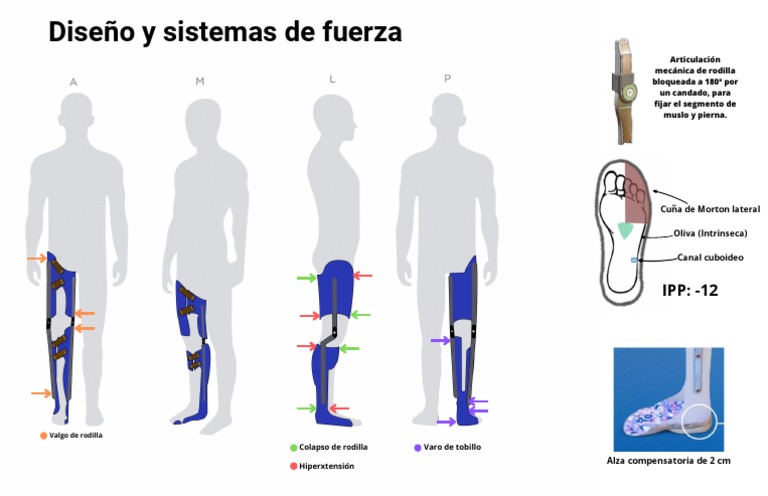 Valgo de rodilla | PDF