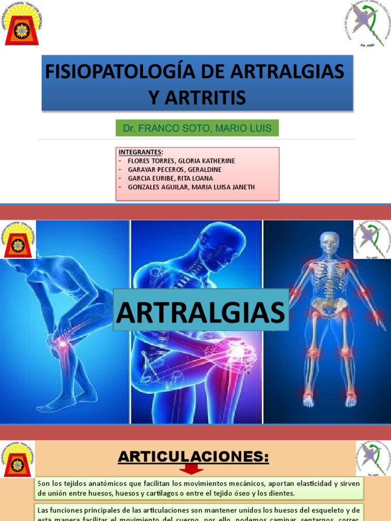 Artralgia y Atrtitis | PDF | Articulación | Artritis Reumatoide