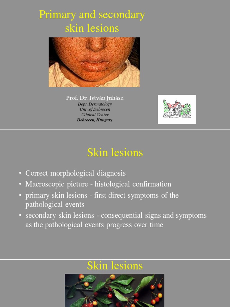 Primary and Secondary Skin Lesions - IJ | PDF | Skin | Scar