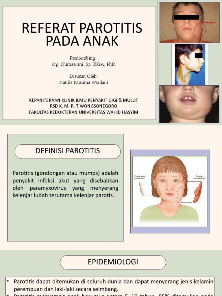 PPT PAROTITIS NAULIA 001 | PDF
