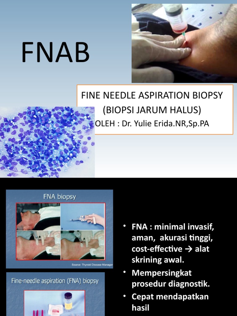FNAB | PDF