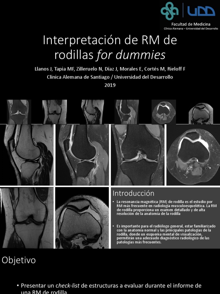 RM Rodilla para Dummies | PDF | Rodilla | Extremidades (anatomía)