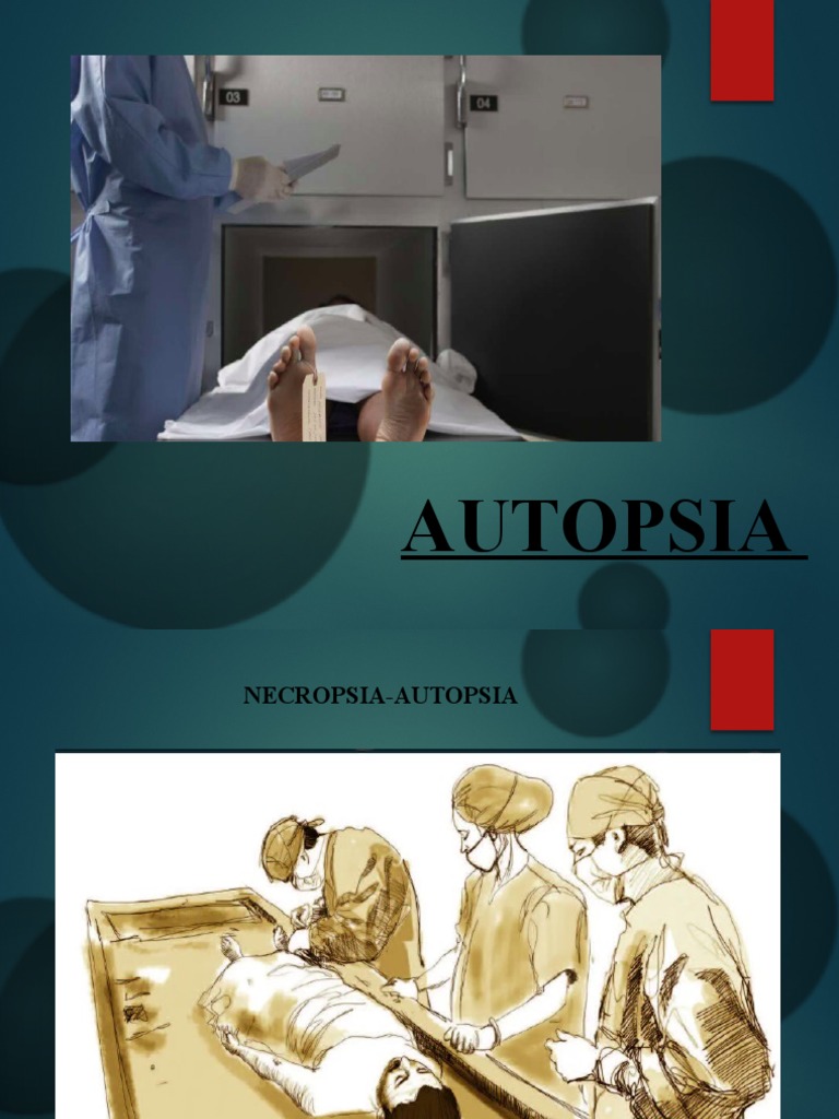 1.- Autopsia | PDF